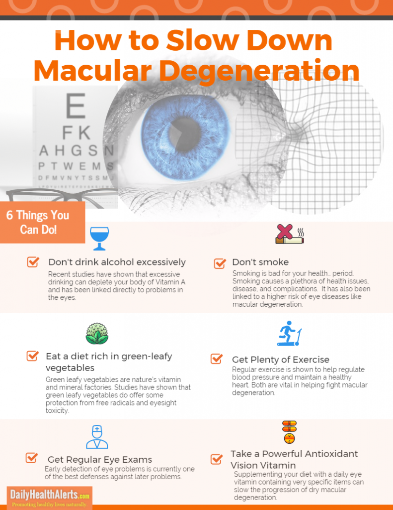 How To Slow Down Macular Degeneration Daily Health Alerts How To Slow Down Macular Degeneration Daily Health Alerts
